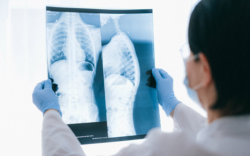 Get Checked for Cancer if You See This on Your Face – Foroveta