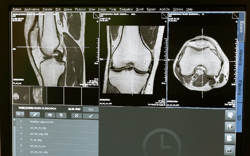 Your Ultimate Manual for Bone Cancer: Symptoms, Diagnosis, and ...