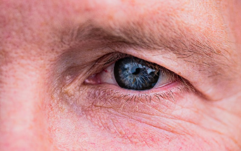 Early Alzheimer’s Detection Starts from the Eyes, Research Found Out ...
